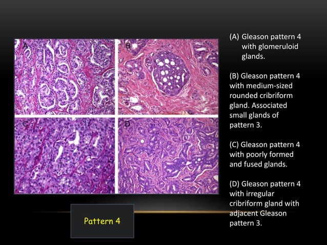 Prostate grossing and reporting | PPTX | Medical Health
