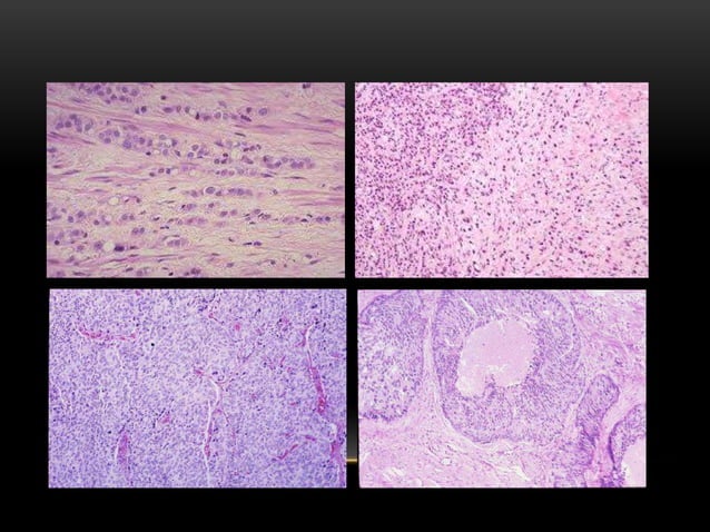 Prostate grossing and reporting | PPTX | Medical Health