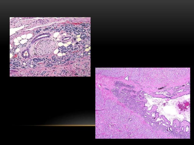 Prostate grossing and reporting | PPTX | Medical Health