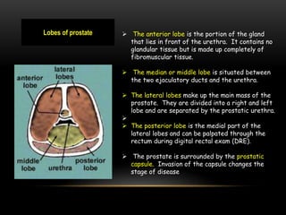 Prostate grossing and reporting | PPTX