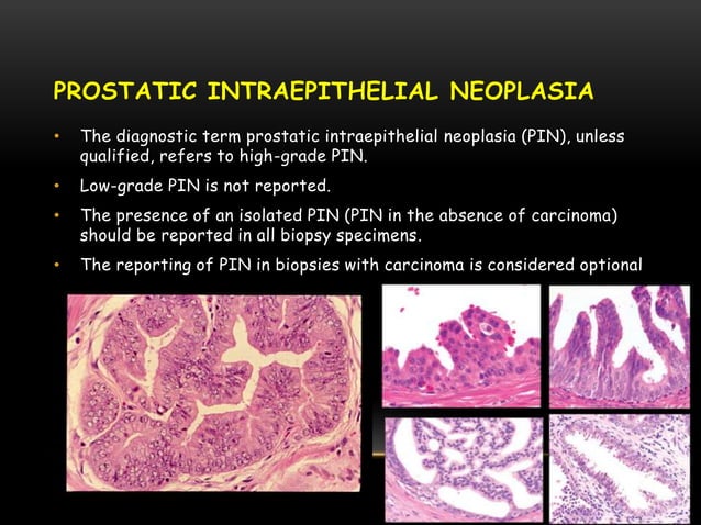 Prostate grossing and reporting | PPTX | Medical Health