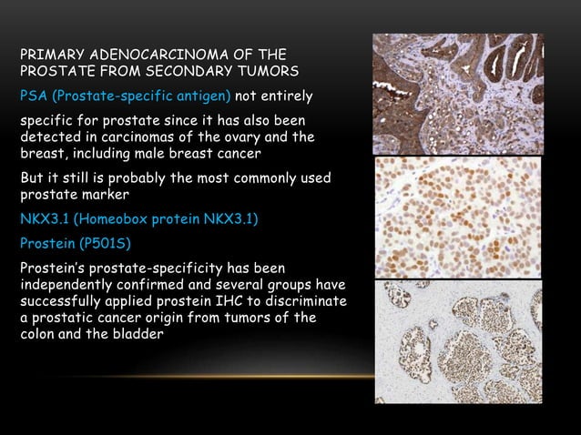 Prostate grossing and reporting | PPTX | Medical Health