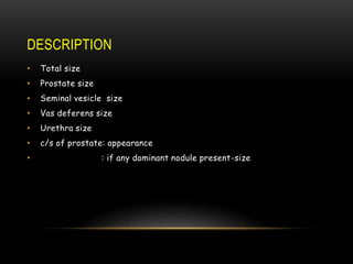 Prostate grossing and reporting | PPTX