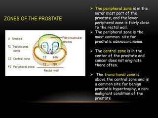 Prostate grossing and reporting | PPT