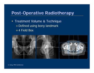 Prostate Imrt | PDF | Physical Therapy | Wellness