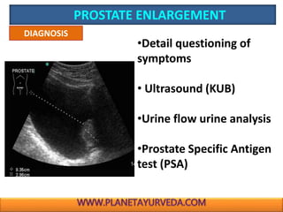 Prostate - Presentation | PPTX