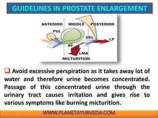 Prostate - Presentation | PPTX
