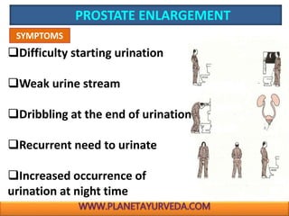 Prostate - Presentation | PPTX