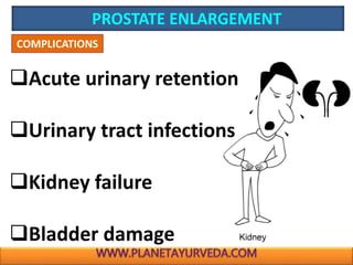 Prostate - Presentation | PPTX