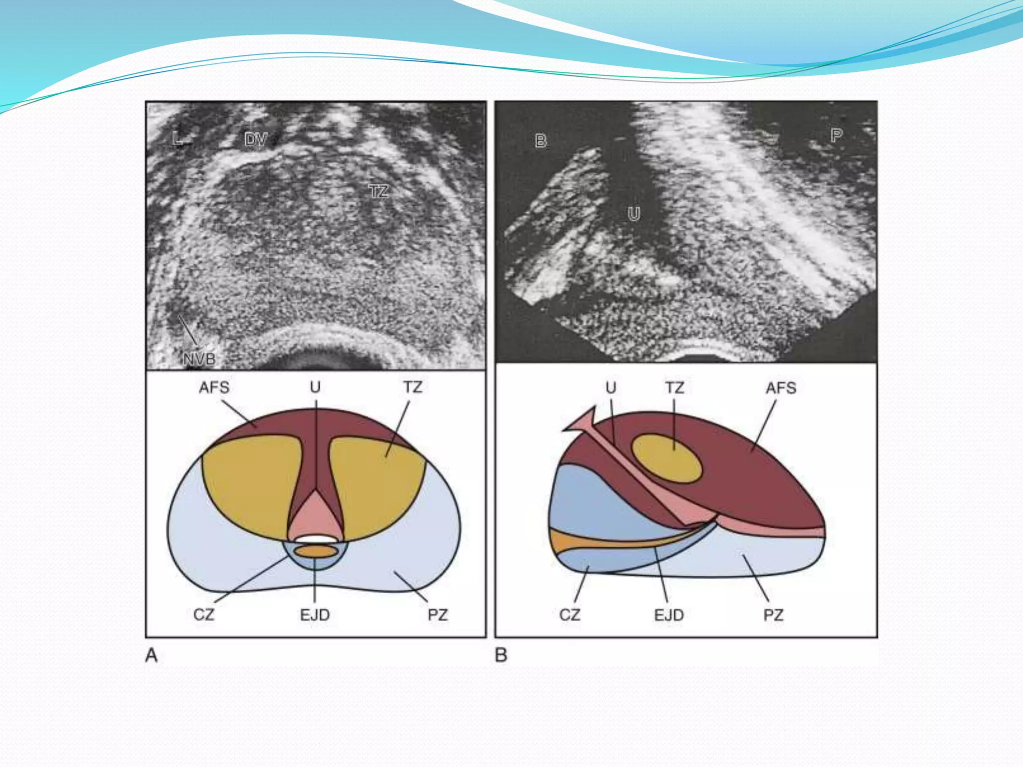 Prostate anatomy | PPTX