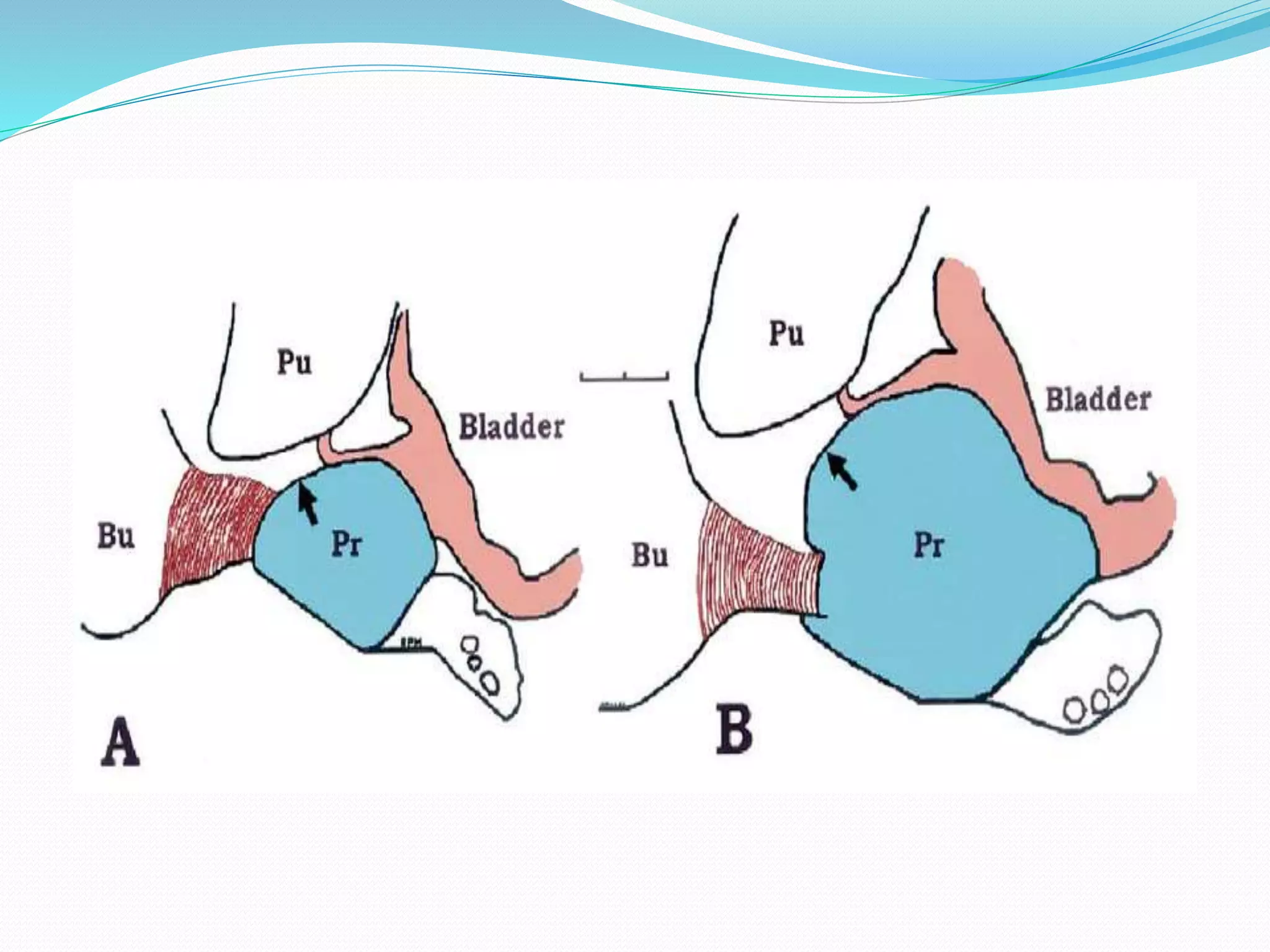 Prostate anatomy | PPTX