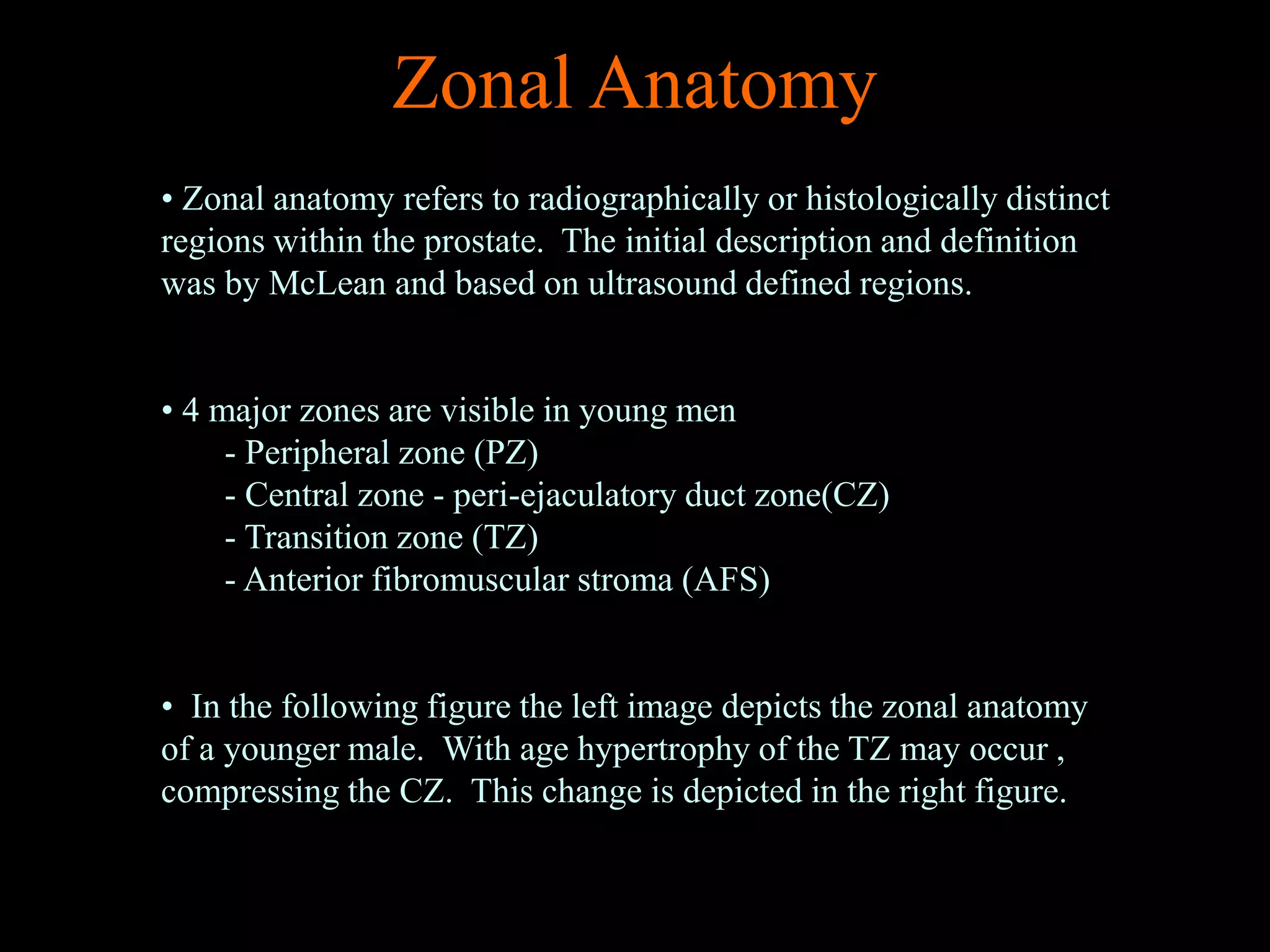Prostate MRI anatomy from UNIVERSITY OF MICHIGAN | PPTX