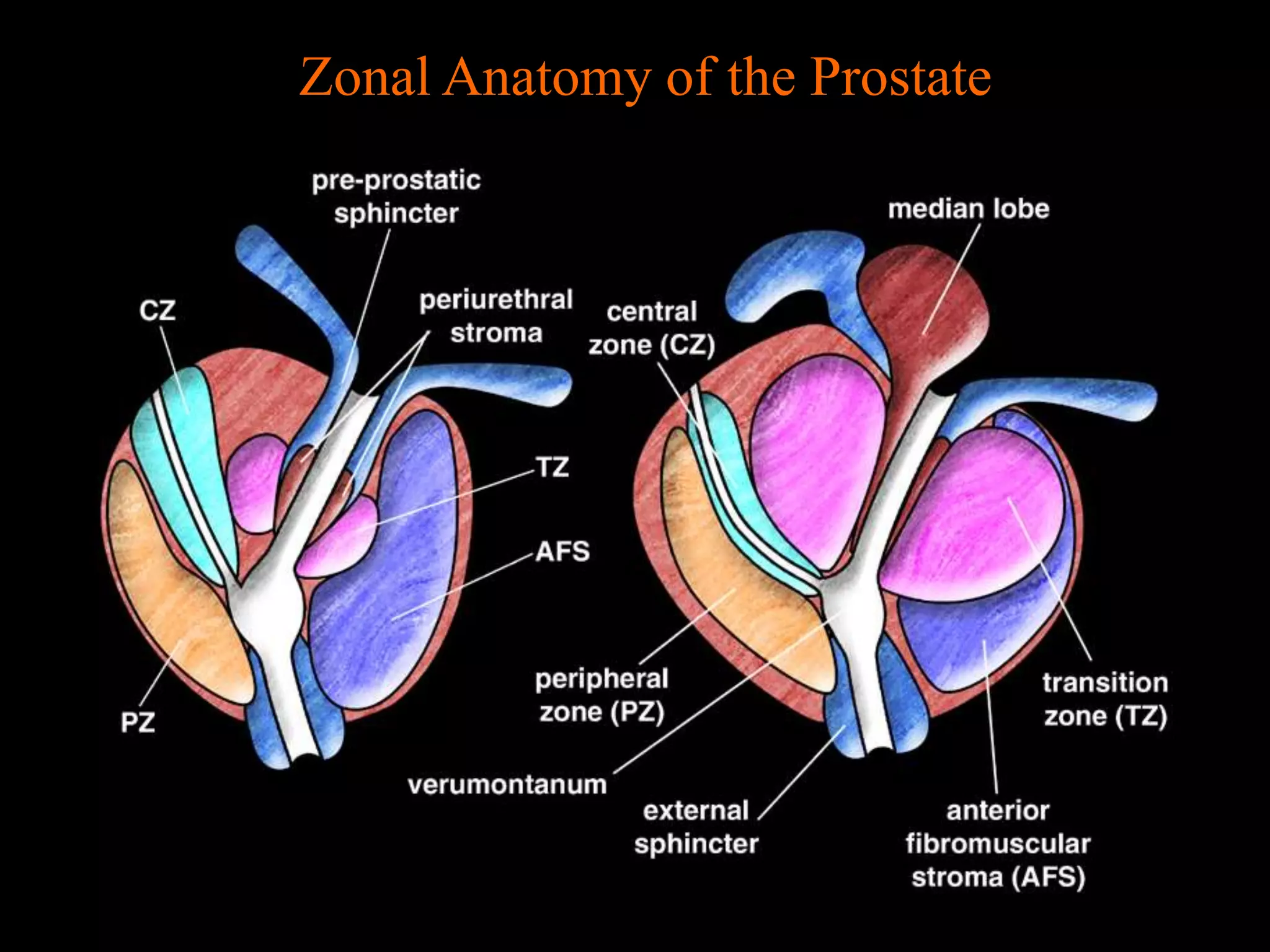 Prostate Mri Anatomy From University Of Michigan Ppt