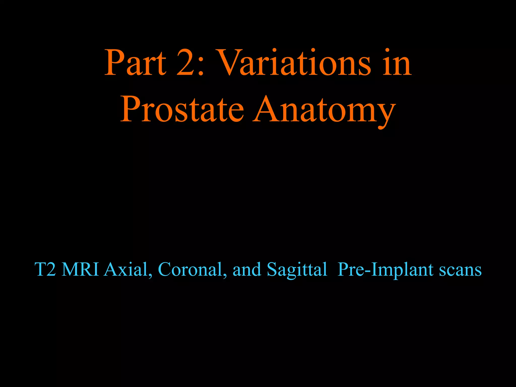 Prostate MRI anatomy from UNIVERSITY OF MICHIGAN | PPTX