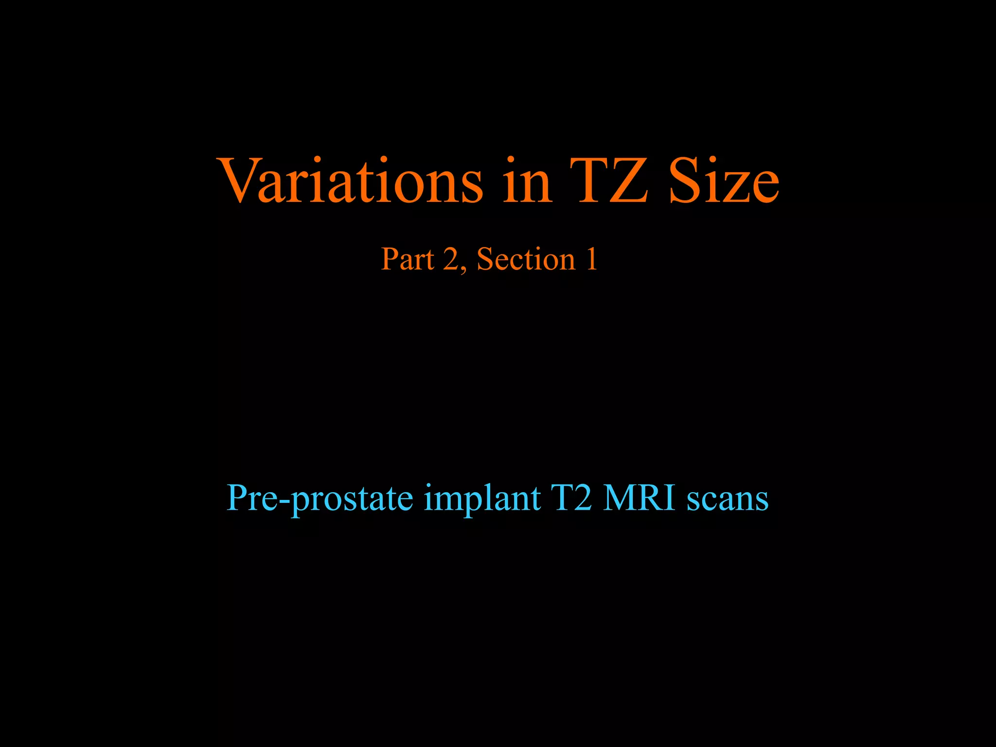 Prostate MRI anatomy from UNIVERSITY OF MICHIGAN | PPTX