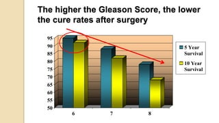 Prostate Cancer and Gleason Score | PPTX