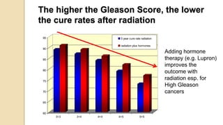 Prostate Cancer and Gleason Score | PPTX