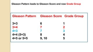 Prostate Cancer and Gleason Score | PPTX