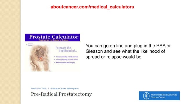 Prostate Cancer and Gleason Score | PPTX
