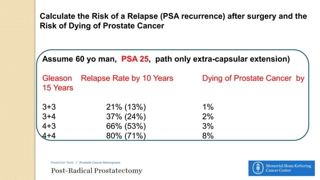 Prostate Cancer and Gleason Score | PPT