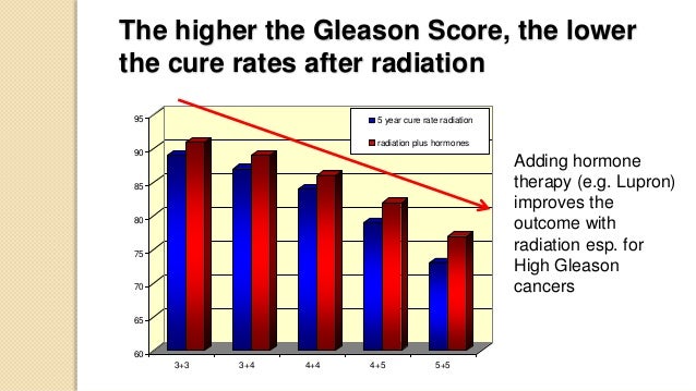 Prostate Cancer and Gleason Score