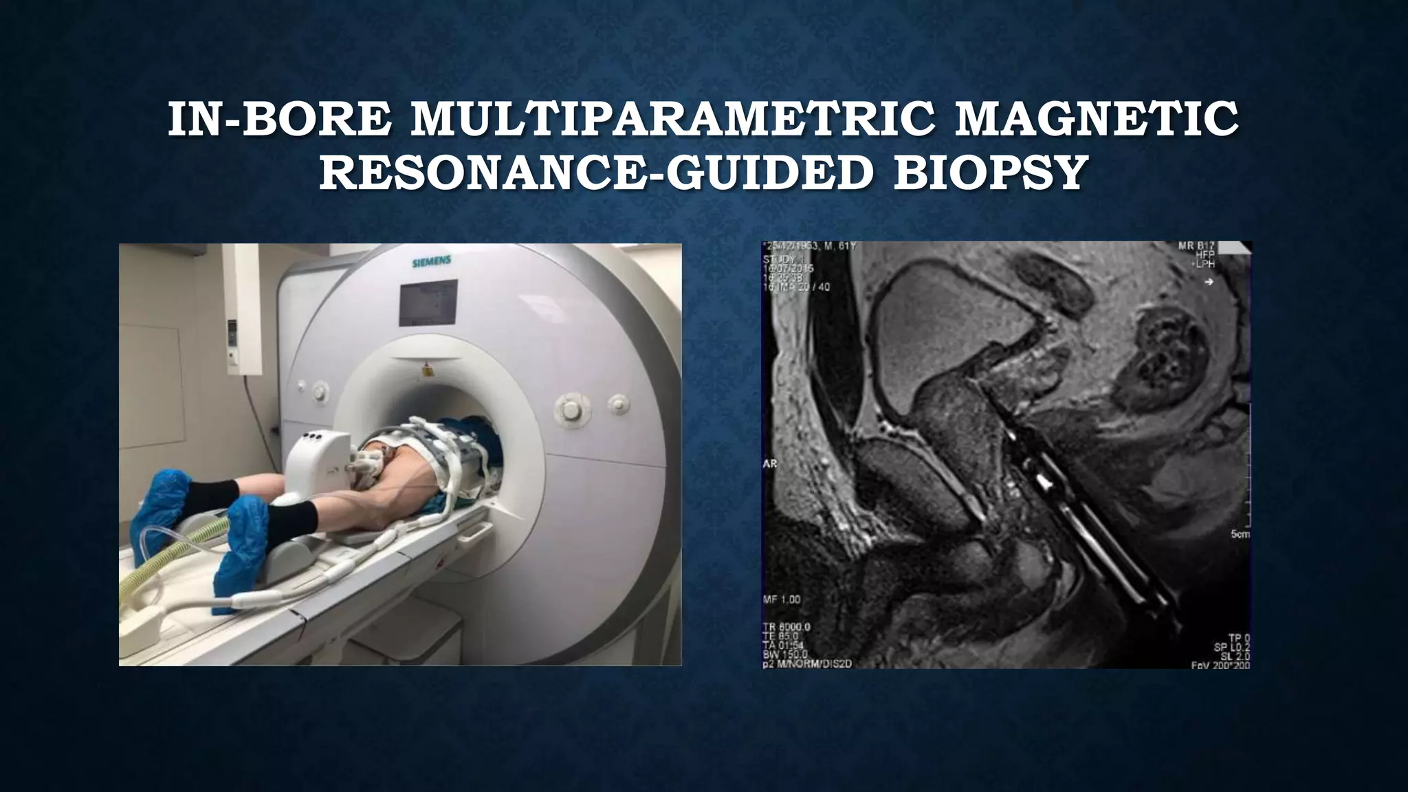Prostate Biopsy.pptx