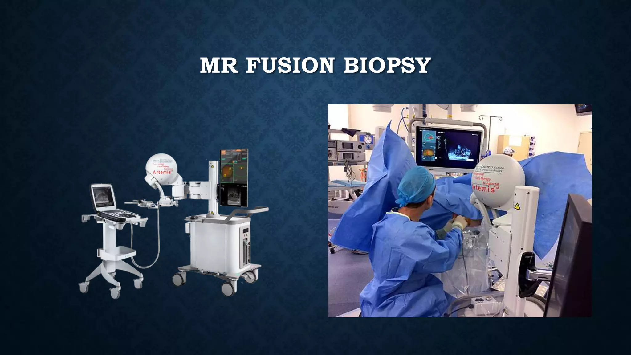 Prostate Biopsy.pptx