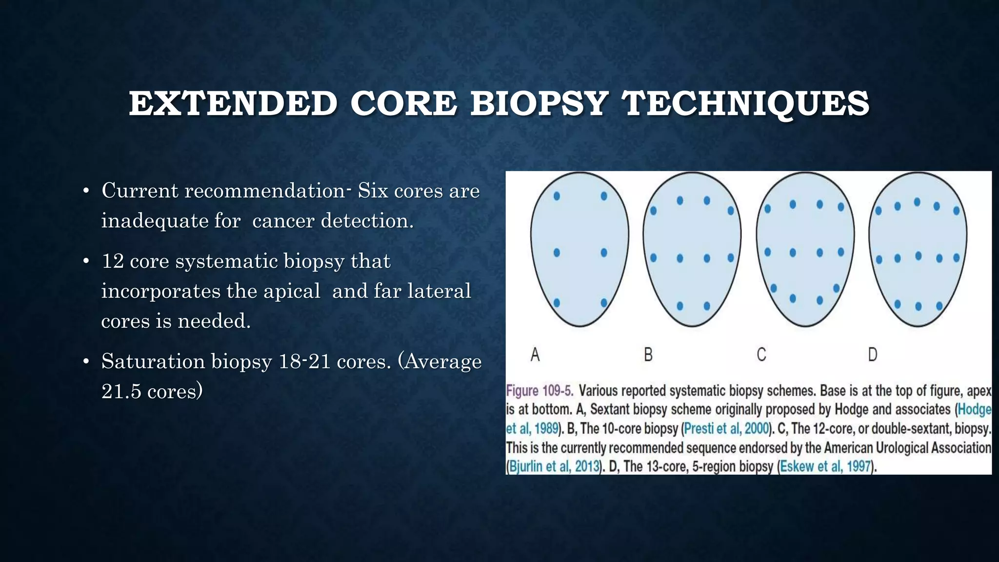 Prostate Biopsy.pptx