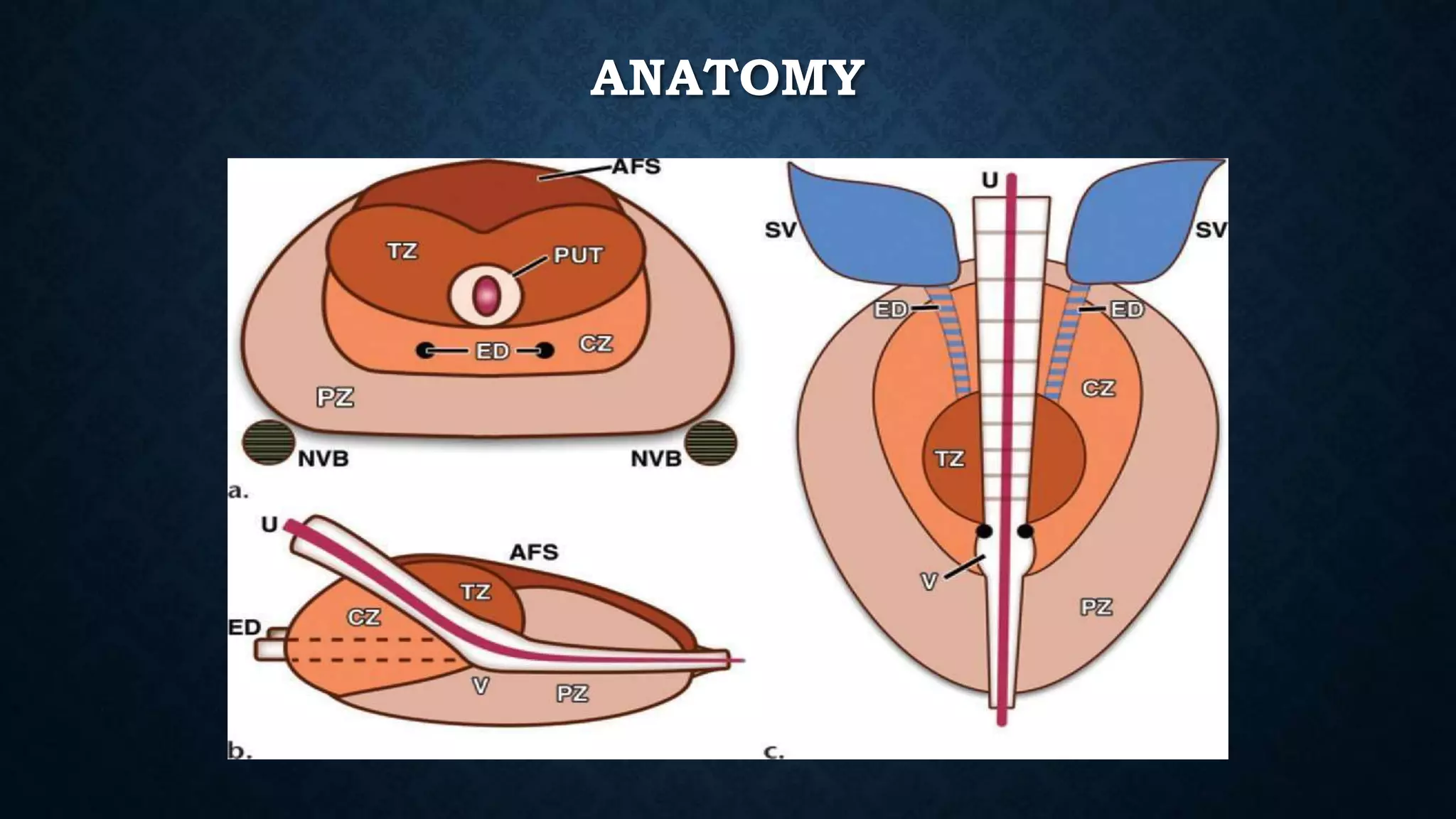 Prostate Biopsy.pptx