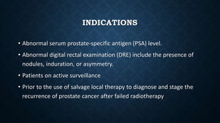 Prostate Biopsy.pptx