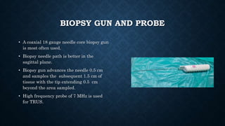 Prostate Biopsy.pptx