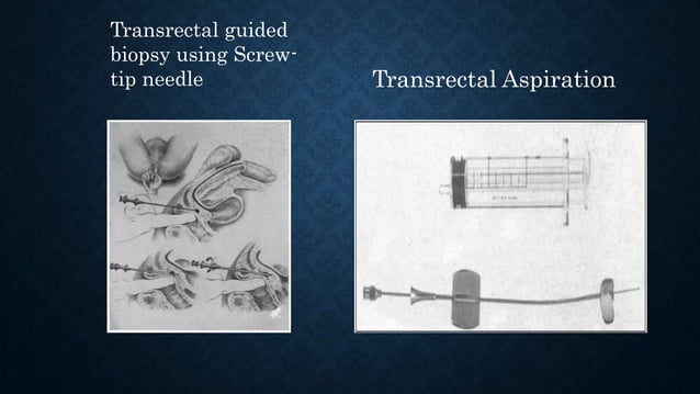 Prostate Biopsy.pptx | Physical Therapy | Wellness