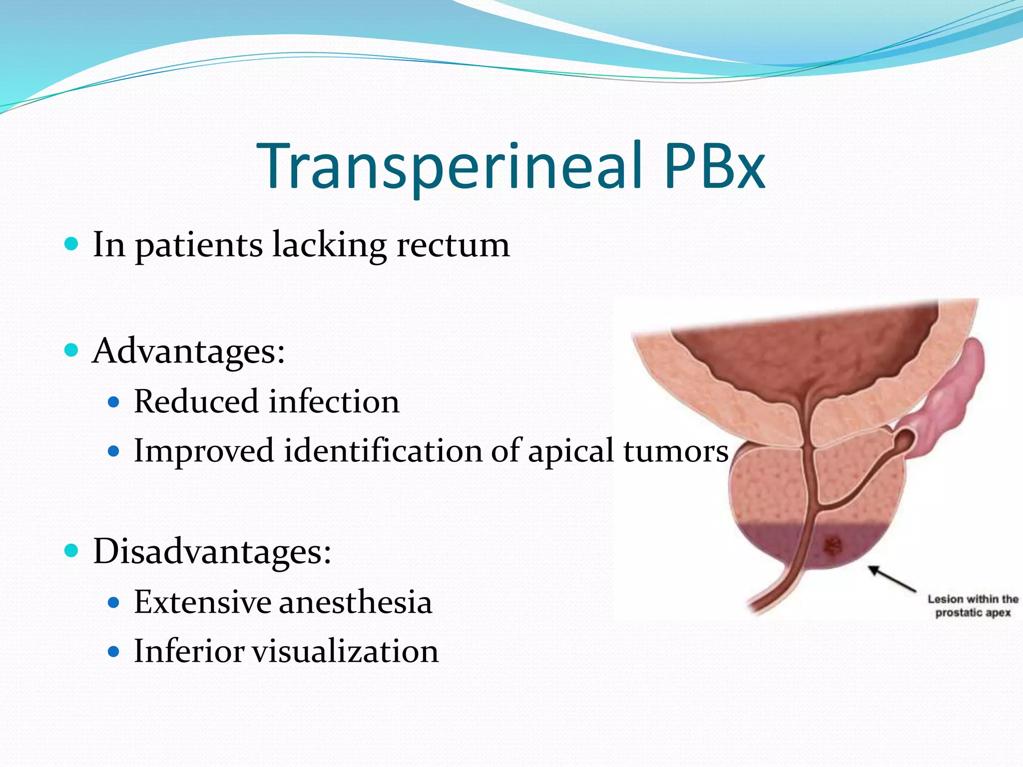 Prostate Biopsy Pbxpptx