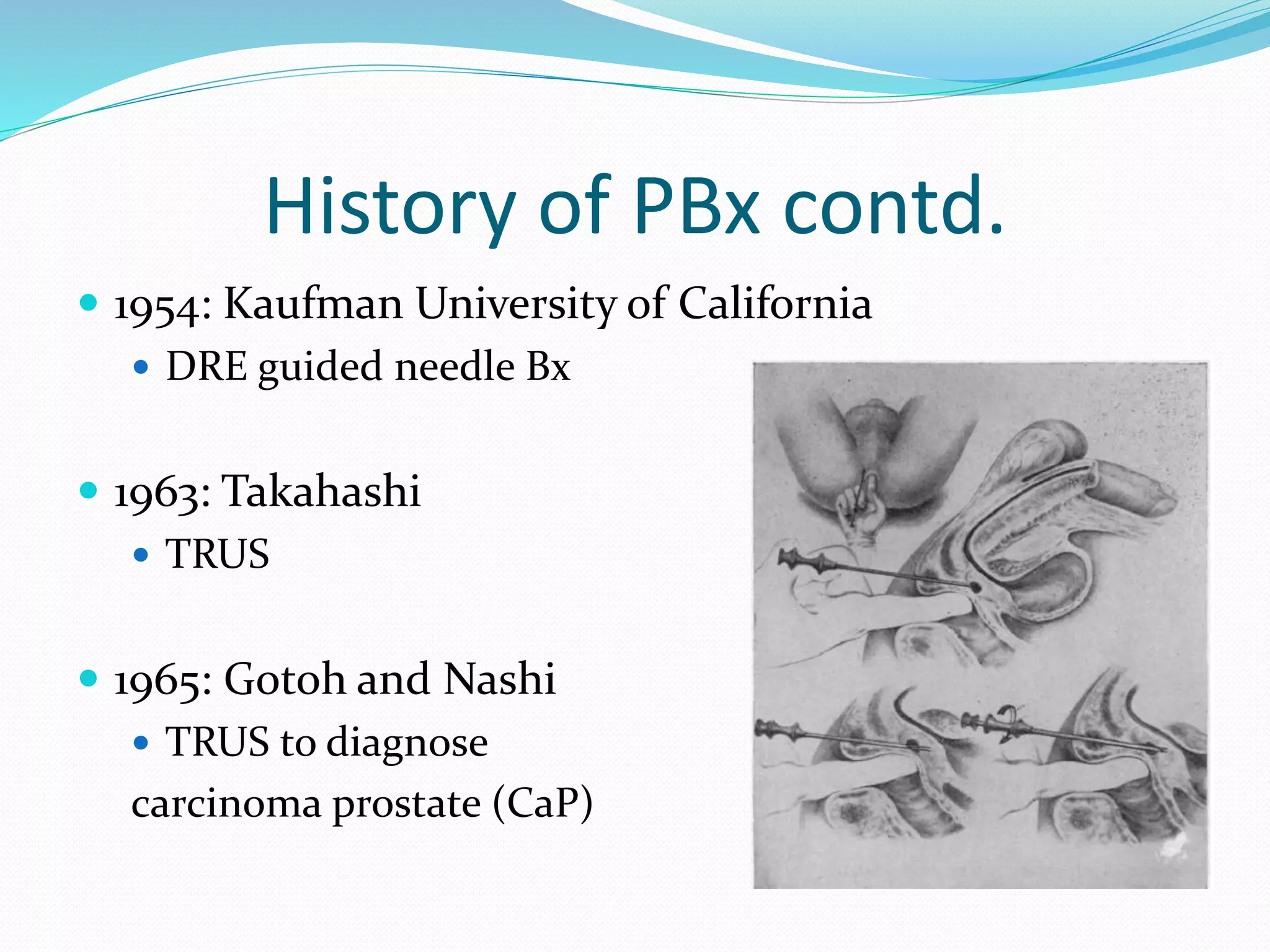 Prostate Biopsy (PBx).pptx