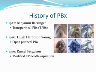 Prostate Biopsy (PBx).pptx