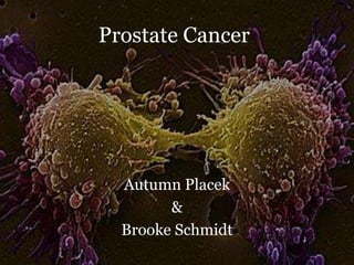 Prostate cancer | PPTX | Cancer | Diseases and Conditions