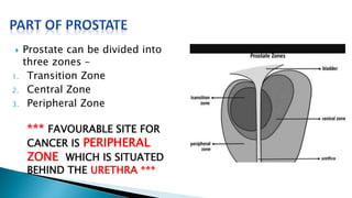 Prostate cancer | PPTX