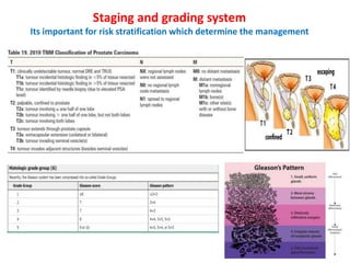 Prostate cancer | PPTX | Cancer | Diseases and Conditions