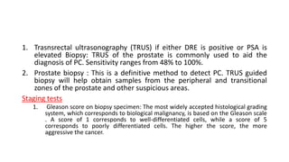 Prostate cancer | PPTX