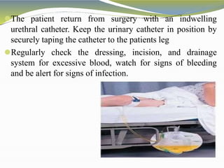 prostatecancer-200417071749.pptx