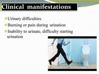 prostatecancer-200417071749.pptx