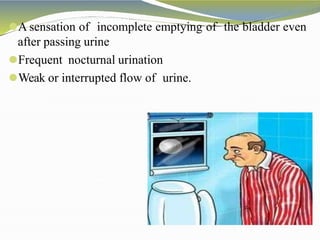 prostatecancer-200417071749.pptx