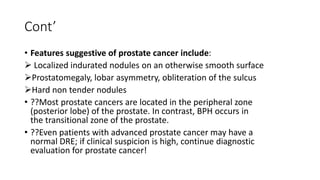 Prostate cancer.pptx