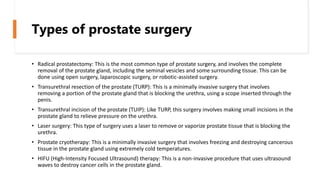 Prostate Cancer.pptx