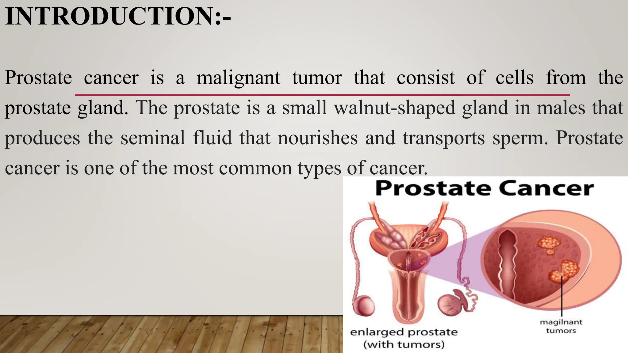 Prostate cancer.pptx