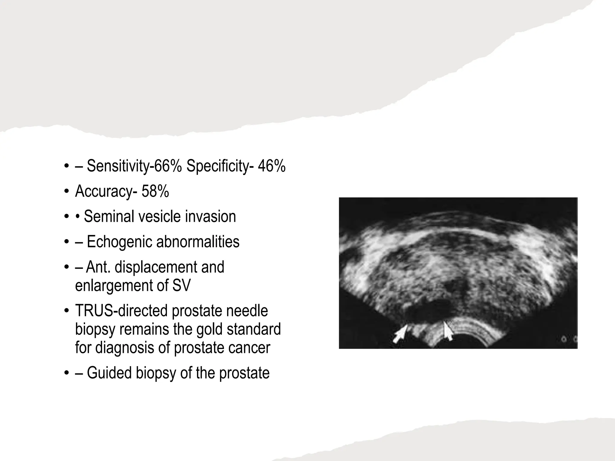 Prostate Cancer.pptx for healthcare professionals | PPTX