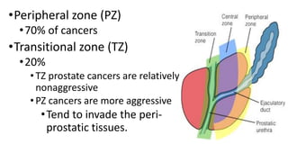 PROSTATE CANCER. a type of cancer that affects the prostate gland | PDF