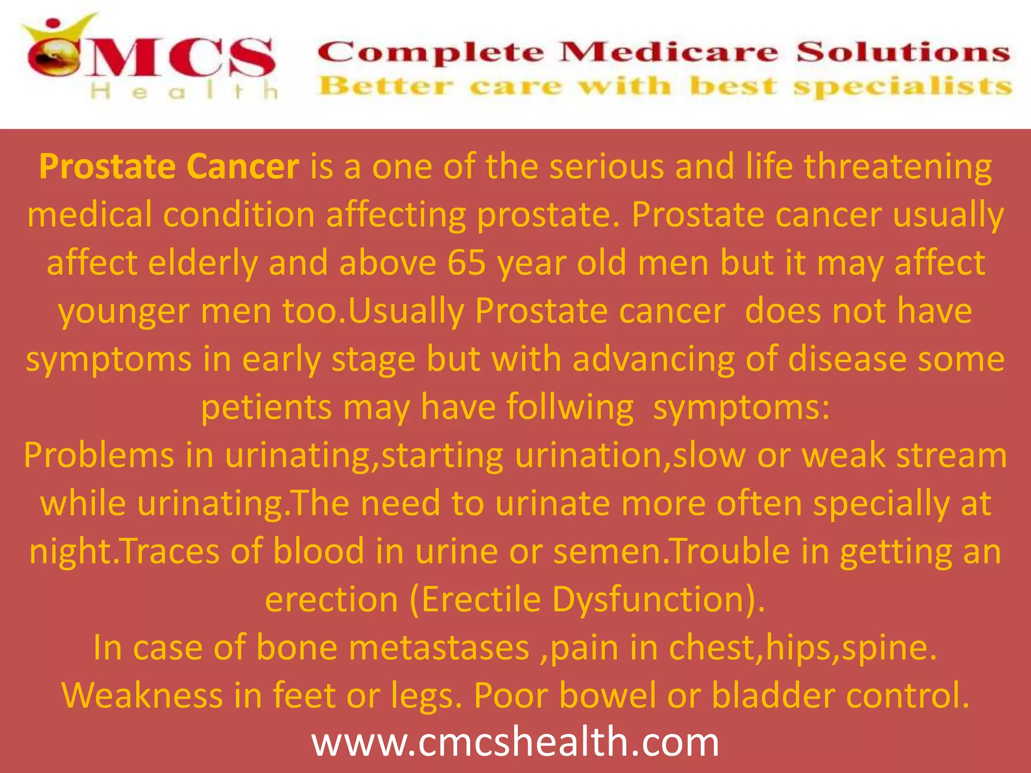 Prostate cancer symptoms diagnosis and treatment. | PPTX