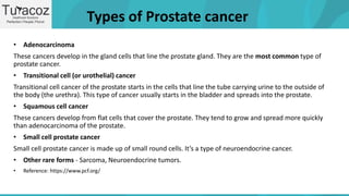 Prostate Cancer by Dr Ankita Purkite | PPTX