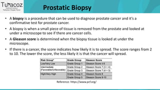Prostate Cancer by Dr Ankita Purkite | PPTX